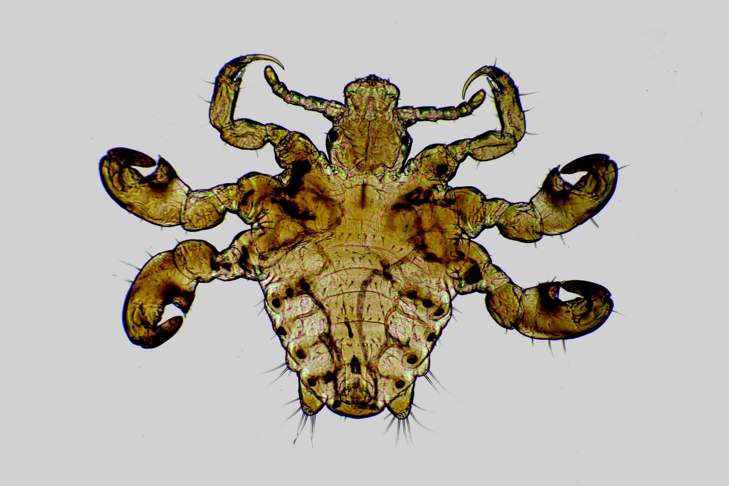 Réf. 162514 — INSECTA > Phthiraptera > Pthiridae > Pthirus pubis - www ...