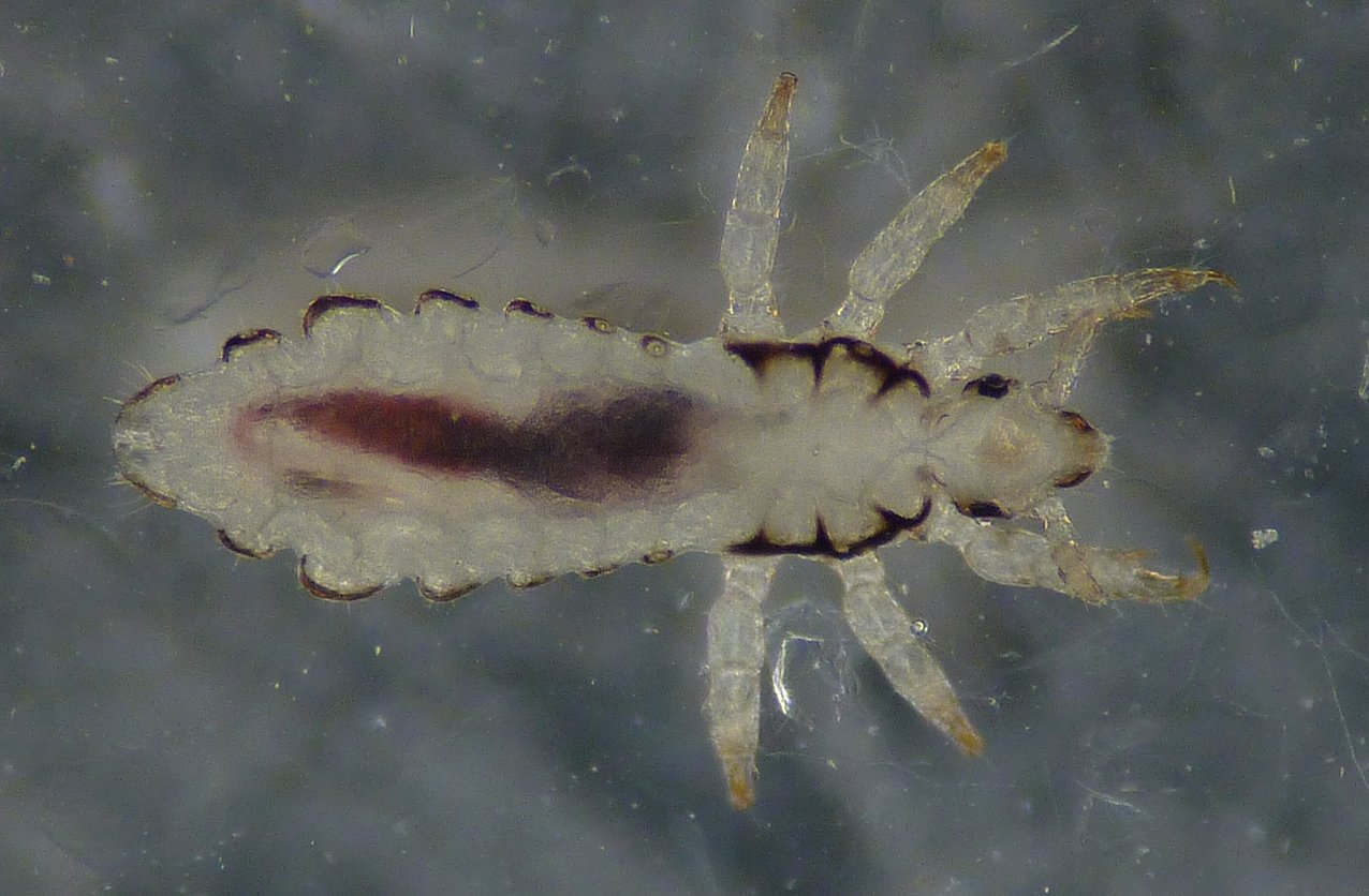 Réf. 168060 — INSECTA > Phthiraptera > Pediculidae > Pediculus humanus ...