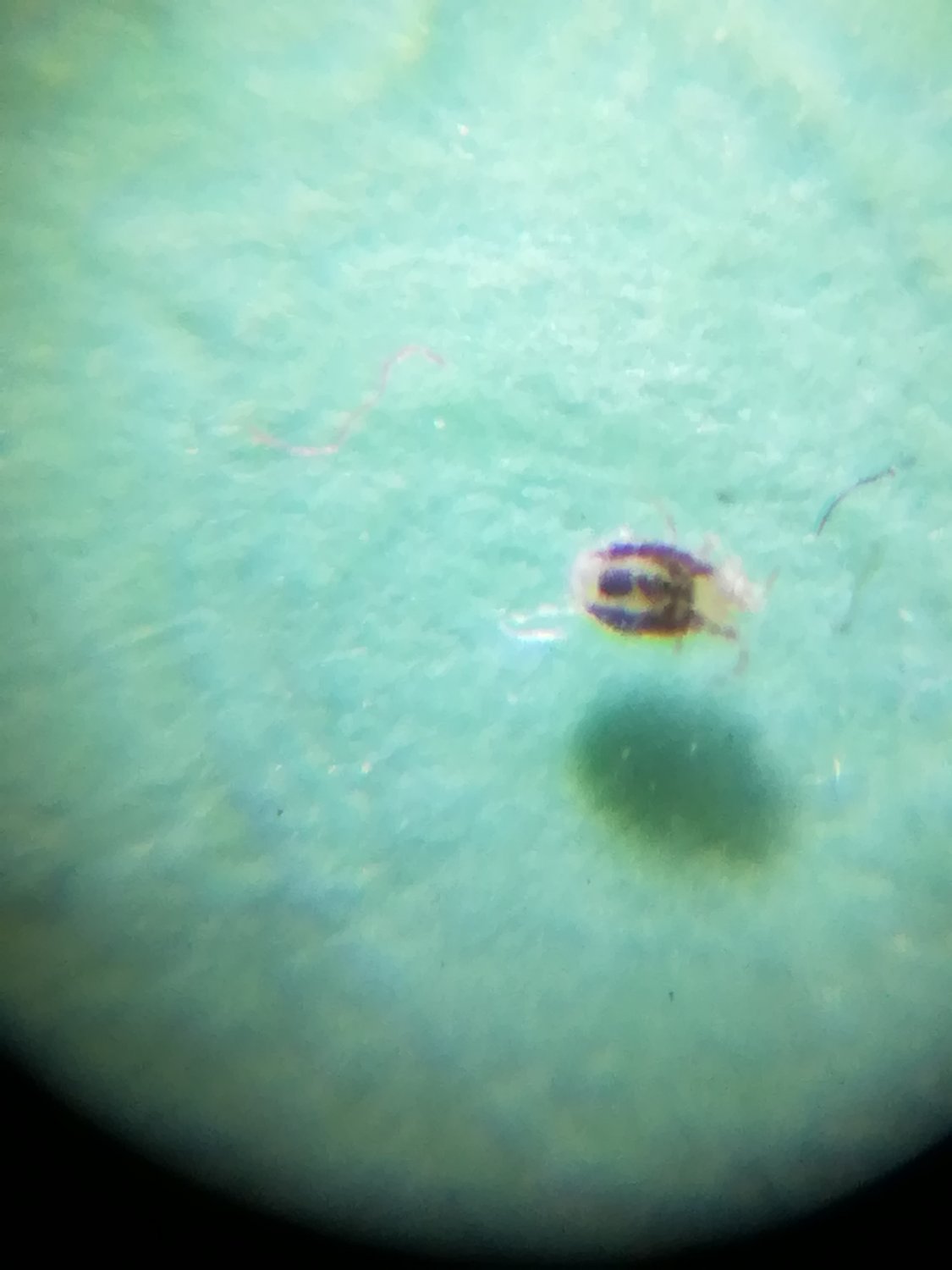 Réf. 223791 — ARACHNIDA > Mesostigmata > Macronyssidae > Ornithonyssus ...