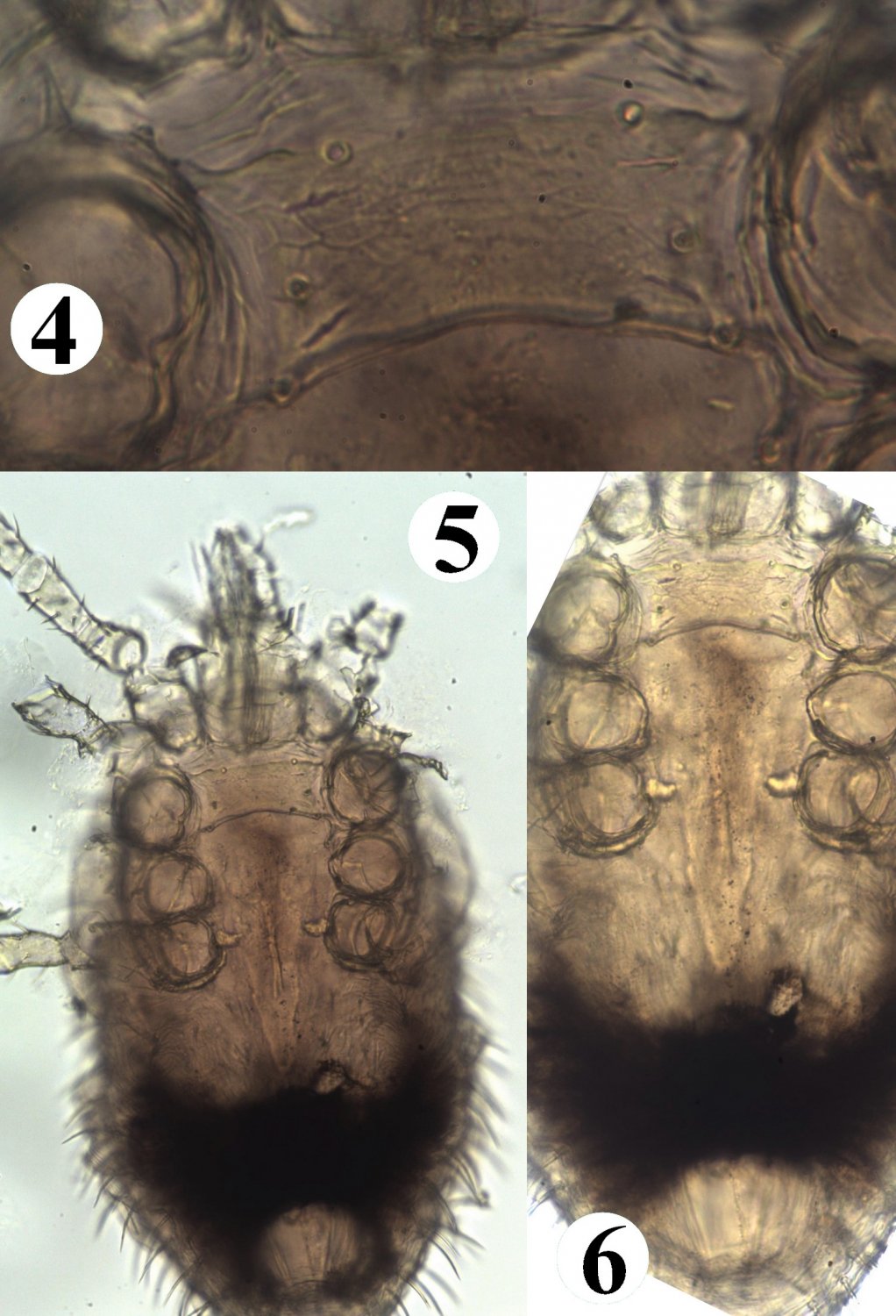 Ornithonyssus bacoti (Arachnida, Mesostigmata, Macronyssidae) - www ...
