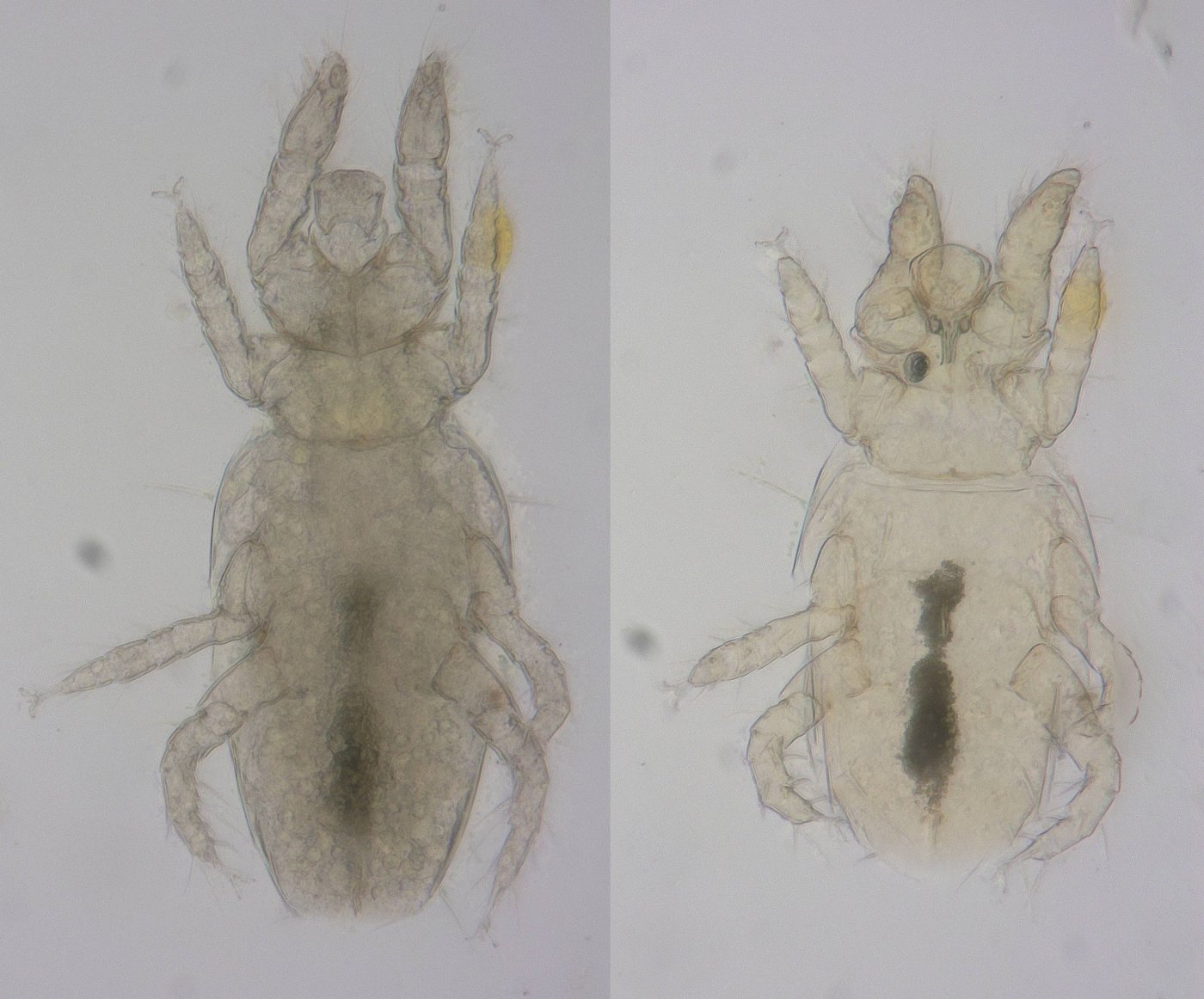 Réf. 317951 — ARACHNIDA > Prostigmata > Pygmephoridae > Inconnu inconnu ...